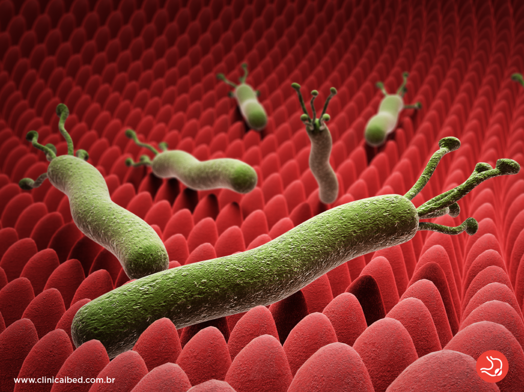 Helicobacter Pylori H Pylori Sintomas Diagnóstico E Tratamento